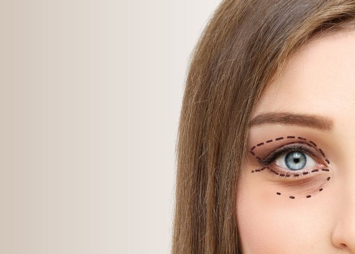 Tratamiento de ojeras - Dr. Sergio Baena - Medicina Estética